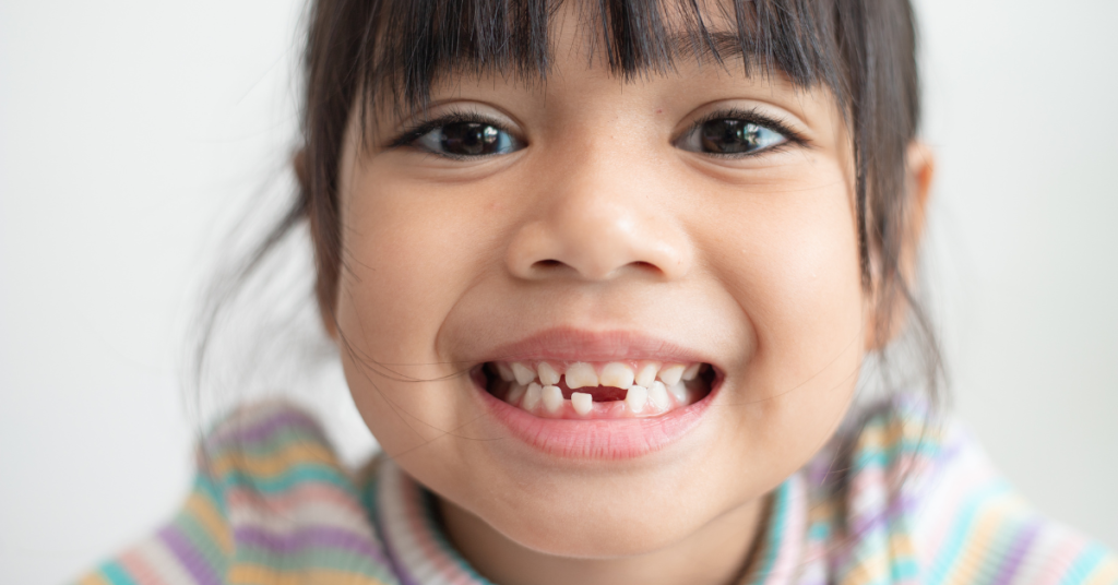 8 Expert Tips to Prevent Misaligned Teeth in Children!